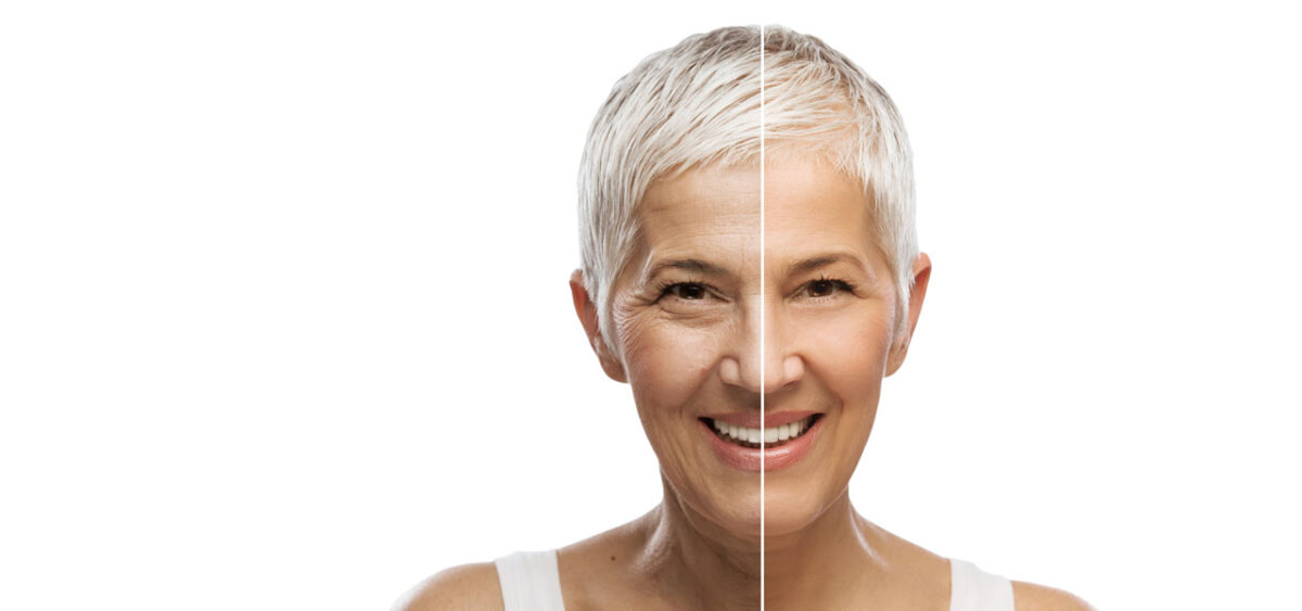 Botox And Nuceiva Treatments In Calgary